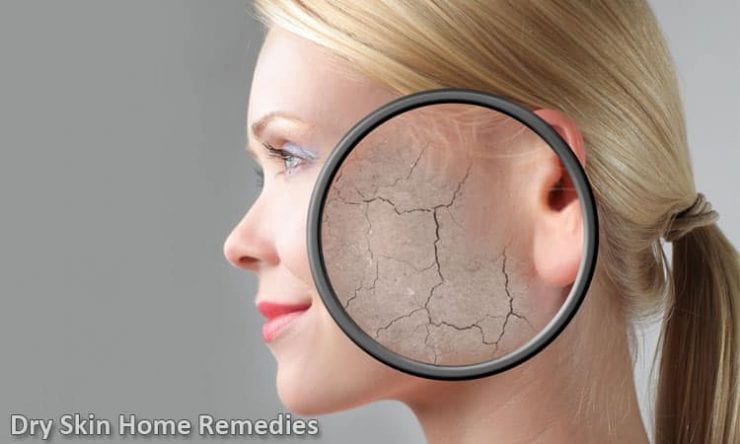 32 Home Remedies for Dry Skin - Home Remedies