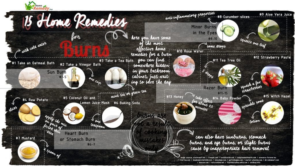 15 Home Remedies for Burns - Home Remedies