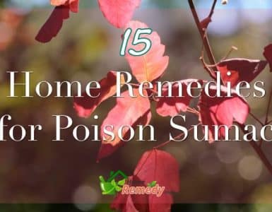 28 Home Remedies for Scar Removal - Home Remedies