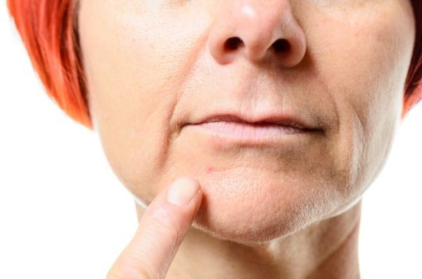 13 Ways to Cure a Blind Pimple! - Home Remedies