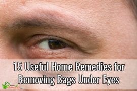 15 Useful Home Remedies for Removing Bags Under Eyes - Home Remedies