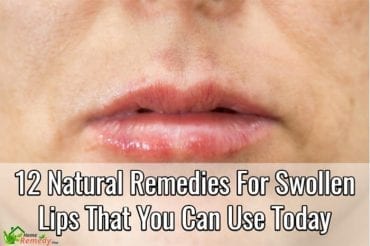 12 Natural Remedies for Swollen Lips That You Can Use Today - Home Remedies
